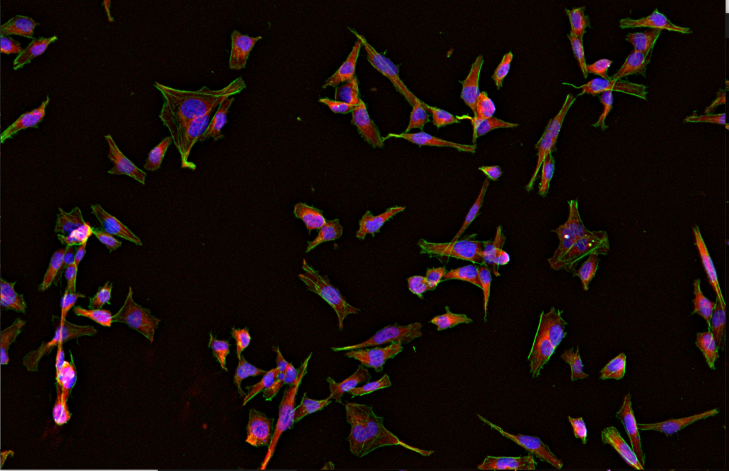 Platelets and Neurovascular Disease Meeting – The Platelet Society